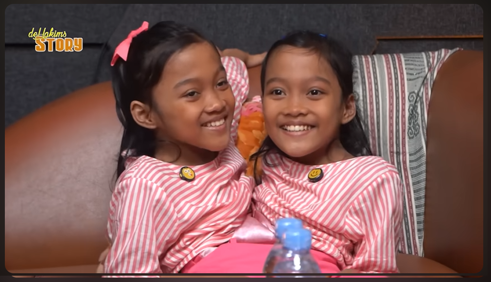 Viral Kisah Kembar Siam Dempet Perut Asal Garut yang Divonis Tak Bisa ...