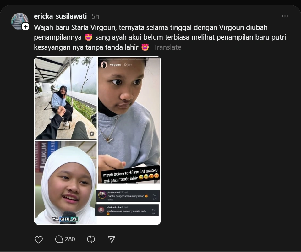 Virgoun Tunjukkan Potret Starla Usai Hilangkan Tanda Lahir, Netizen Puji Mantan Inara Rusli